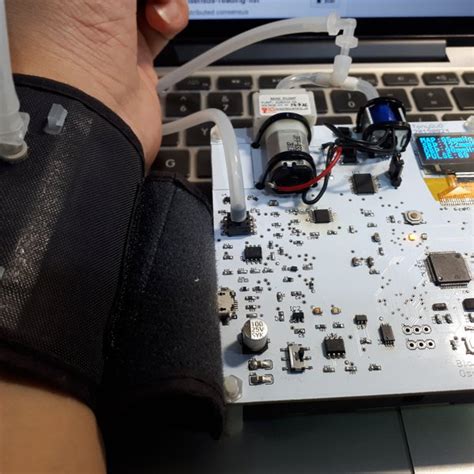 A Fib Detection Blood Pressure Monitor Hackaday Io