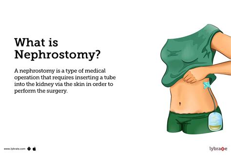 Nephrostomy Causes Symptoms Treatment And Cost