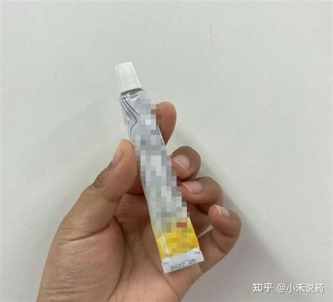 家庭常备药系列之——抗过敏药 知乎