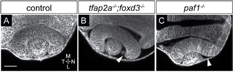 Neural Crest Cells Regulate Optic Cup Morphogenesis By Promoting Extracellular Matrix Assembly