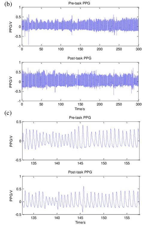 a ppg glasses [21] b the raw ppg signal before and after task 1