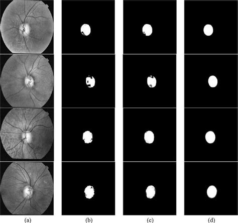 the segmentation results by the proposed method based on drishti gs