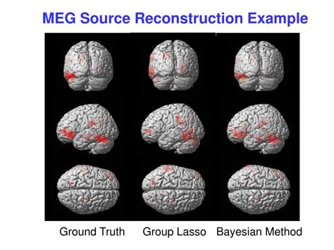 Ppt Lecture Iv A Bayesian Viewpoint On Sparse Models Powerpoint