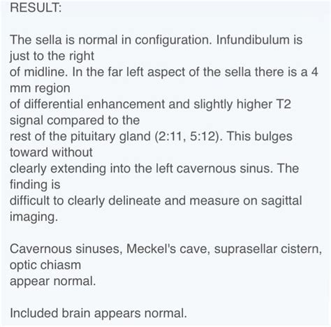Hey Team What Are Your Side Effects From Cabergolinedostinex For