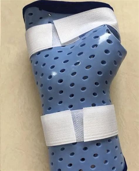 Lay3d Multicolor Low Temperature Thermoplastic Splint Material At Rs 4000 In Coimbatore