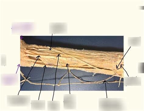 Lower Arm Flexors Diagram Quizlet