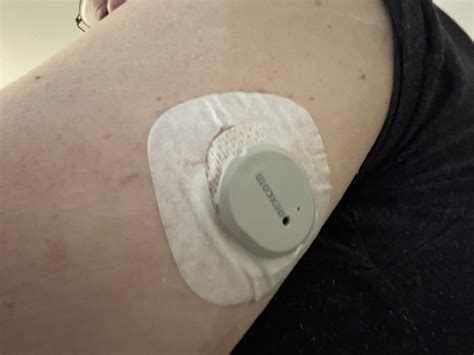How Do You Get In Contact With Dexcom To Replace Faulty Sensor Rdexcom