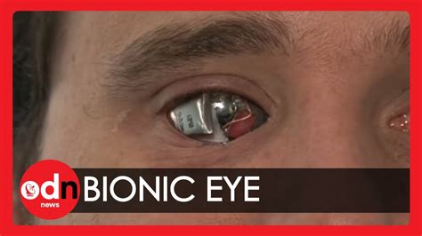 Robotic Eyes