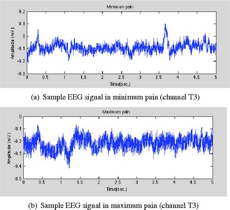 Figure 1 From Migraine Analysis Through Eeg Signals With Classification Approach Semantic Scholar