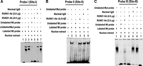Platelet Protein Kinase C θ Deficiency With Human Runx1 Mutation