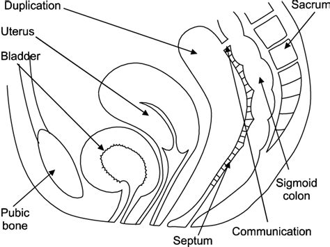Schematic Diagram Of Surgical Findings Download Scientific Diagram