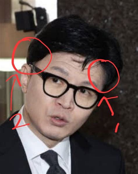 한동훈 가발 대머리 진실 ~ 인스티즈 Instiz 이슈 카테고리