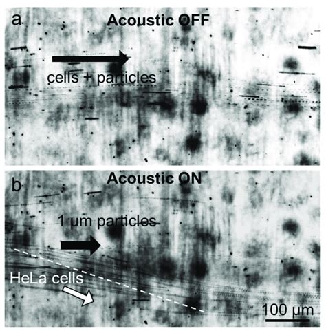 Separation Of Hela Cells And Polystyrene Particles Is Shown By Stacked