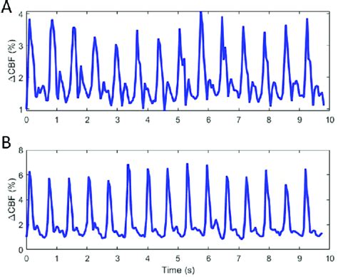 Pulsatile Waveforms Observed In Cerebral Microcirculation Measured At Download Scientific