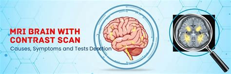 What Is Mri Brain With Contrast Scan