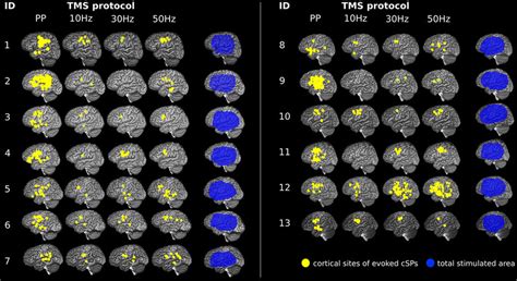 Individual Cortical Representations Of CSPs The Locations Where CSPs Download Scientific