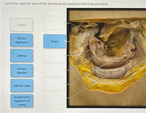 Solved Label The Superior View Of The Female Pelvis Based On