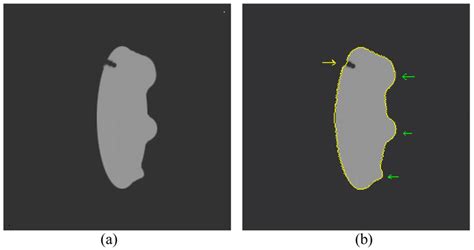 An Artificial Image Mimics The Bladder Wall Which Shows How The Bent