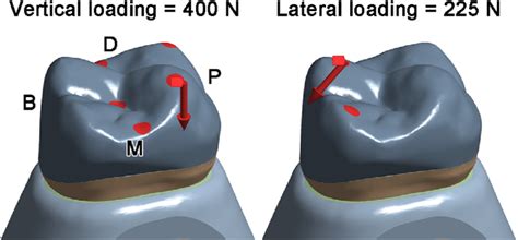 Schematics Of Force Loading B Buccal D Distal M Mesial P Download Scientific