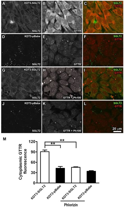 Ac Kdt3 Sglt2 Cells With Positive Sglt2 Immunofluorescence Displayed