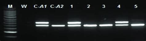 Molecular Patterns Identified With Mating Types A1 And A2 Fragments Download Scientific