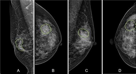 Architectural Distortion At Savannah Mccarthy Blog