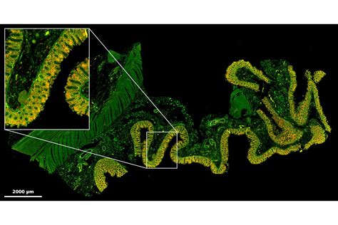 Microscopy Solutions For Pathology Zeiss Microscopy Us