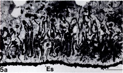 distal parts of ruffle ended maturative ameloblasts adjacentto enamel
