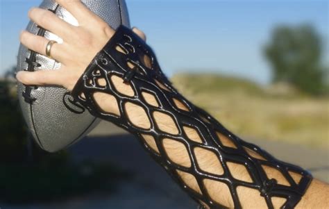Amphibianskin Offers An Affordable 3d Printed Splint To Help The Healing Process 3d Printing