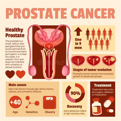 Flat Cartoon Infographic Detailing Prostate Cancer Risk Factors And