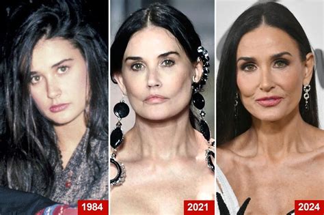 Demi Moore Plastic Surgery All Speculations Unveiled