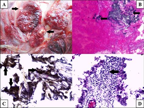 Placenta A Caseous Lesion B Severe Fibrinoid Necrosis And
