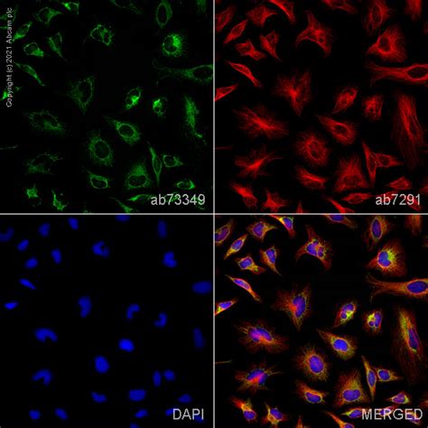 Anti Peroxiredoxin 3prdx3 Antibody Ab73349 Abcam