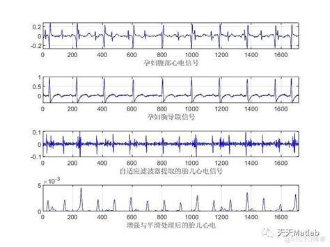 【心电信号ecg】基于nlms算法实现孕妇胎儿心电信号提取附matlab代码 csdn博客