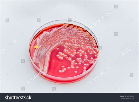 Staphylococcus Aureus Grampositive Gramvariable Nonmotile Coccusbeta