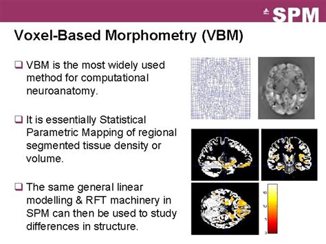 Statistical Parametric Mapping For F Mri Vbm Guillaume