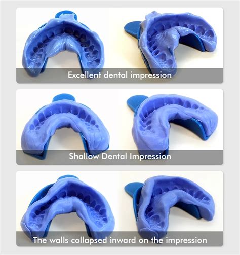 2024 Dental Impression Material Putty Pvs Molding Kit Consumables Clinic Use Silicone Putty