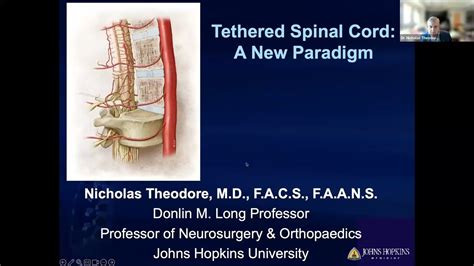 Tethered Spinal Cord Syndrome Dynamic Magnetic Resonance Imaging