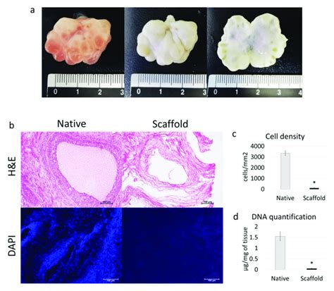 Macroscopic And Microscopic Evaluations Of Ecm Based Scaffolds And Dna Download Scientific