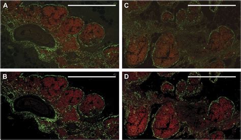 Application Of Deconvolution Microscopy Further Reduces Background And
