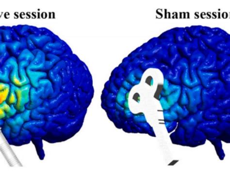 If 6 6 Brain Stimulation Over The Left Dlpfcenhances Motivation For Effortful Rewards