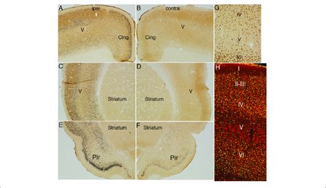 Direct Cortical Electrical Stimulation Activates Immediate Early Gene