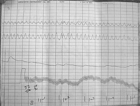 Damien Echols Polygraph Charts May 10 1993