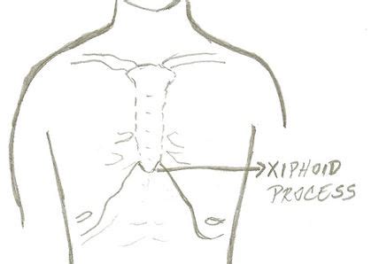 Xiphoid Process Vertebral Level