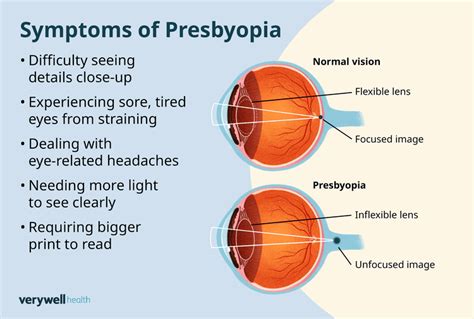 Presbyopia How Aging Affects Your Vision