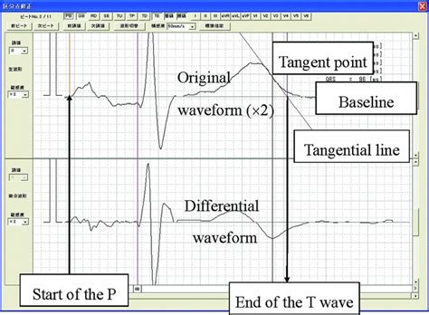 Measurement By The Tangent Method In The Tangent Method The Maximum Download Scientific