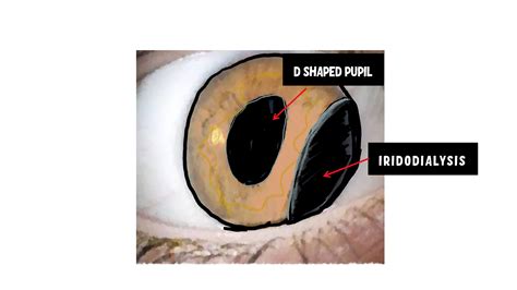 Anatomy Of Angle And Anterior Chamber Of Eye Insight Ophthalmology