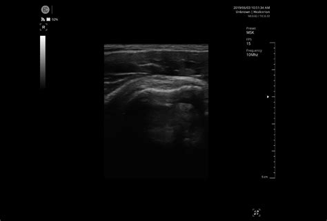 Ultrasound 300l Greentact Healthcare