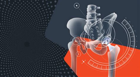 Zimmer Biomet To Acquire Orthogrid Systems Bonezone