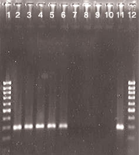 Sensitivity Of Pcr For Detection Of Bvdv 1 Rna Extracted From 10 Fold
